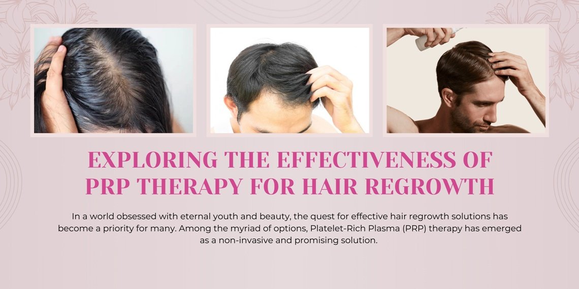 Exploring the Effectiveness of PRP Therapy for Hair Regrowth - Top ...